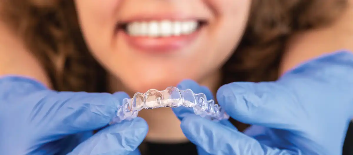 What is the Cost of Invisalign - and Is It Worth It? | Spirit Dental ...